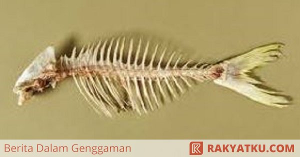 Sakit Perut Parah, Ternyata Sudah 8 Tahun Ada Tulang Ikan di Hati ...