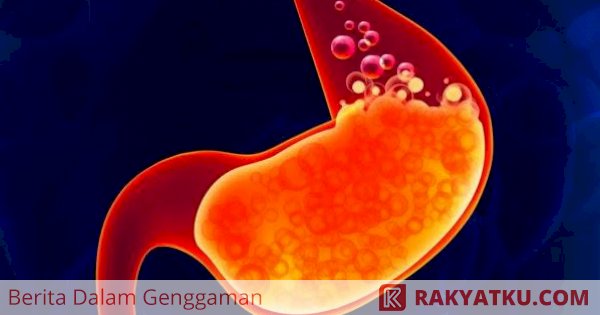 Gejala, Penyebab, dan Diagnosis Penyakit Asam Lambung